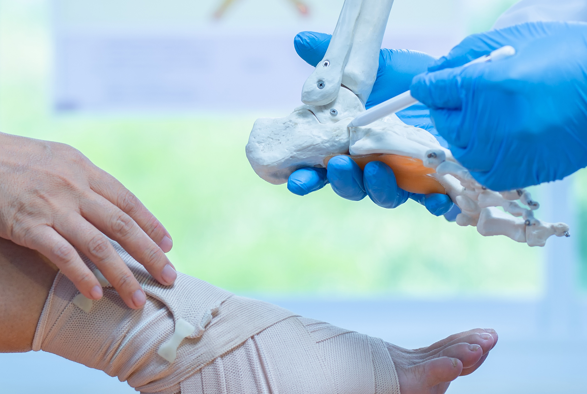 Bone Injury Healing - Power of platelets